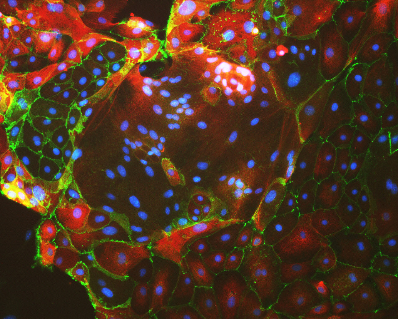 Researchers Transform Human Skin Cells into Functional Placenta Cells ...