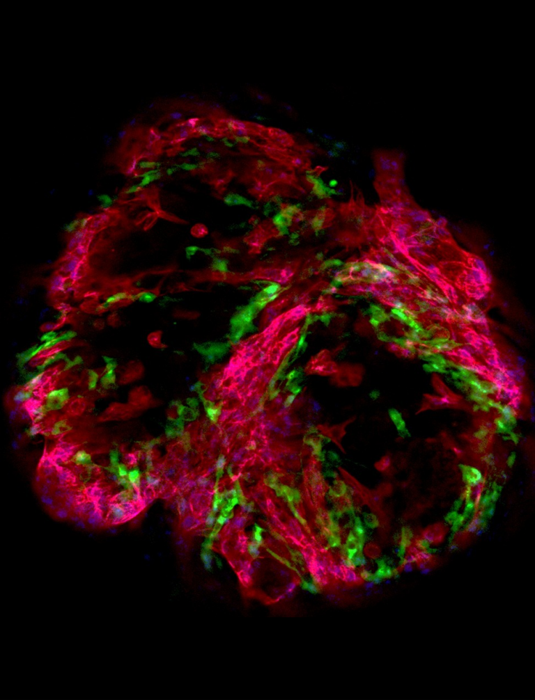 Tiny, Multichambered Human Heart Model Could Transform Cardiovascular ...